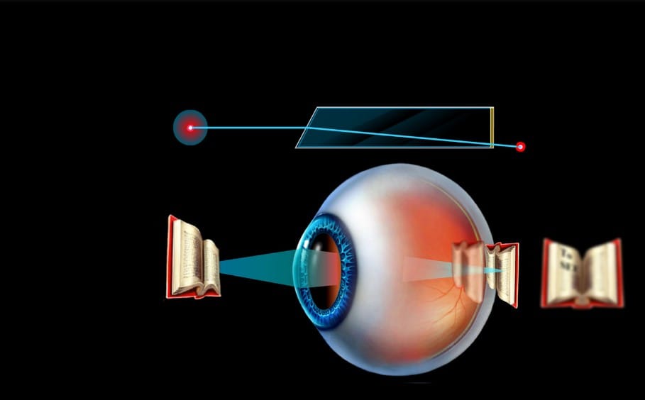 Understanding Common Vision Problems: Myopia, Hyperopia, Astigmatism - Christopher Young Opticians