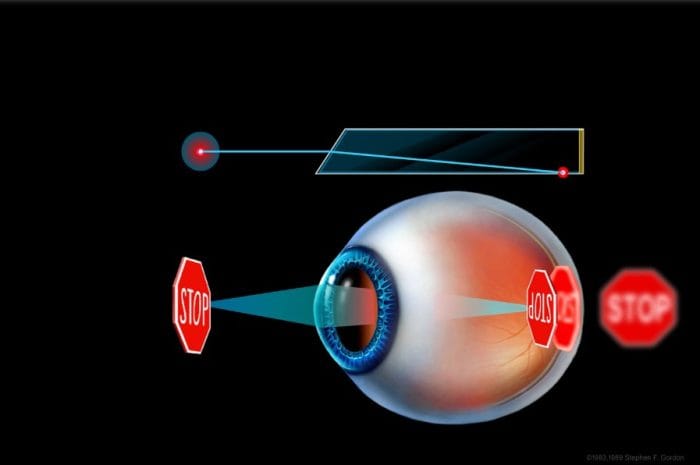 Understanding Common Vision Problems: Myopia, Hyperopia, Astigmatism - Christopher Young Opticians